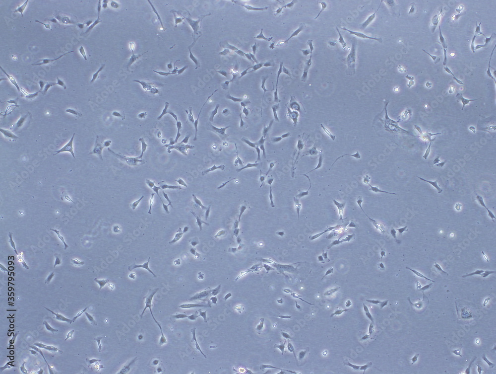 Human Brain Endothelial Cells (hCMEC/D3 cells) were captured by Light ...