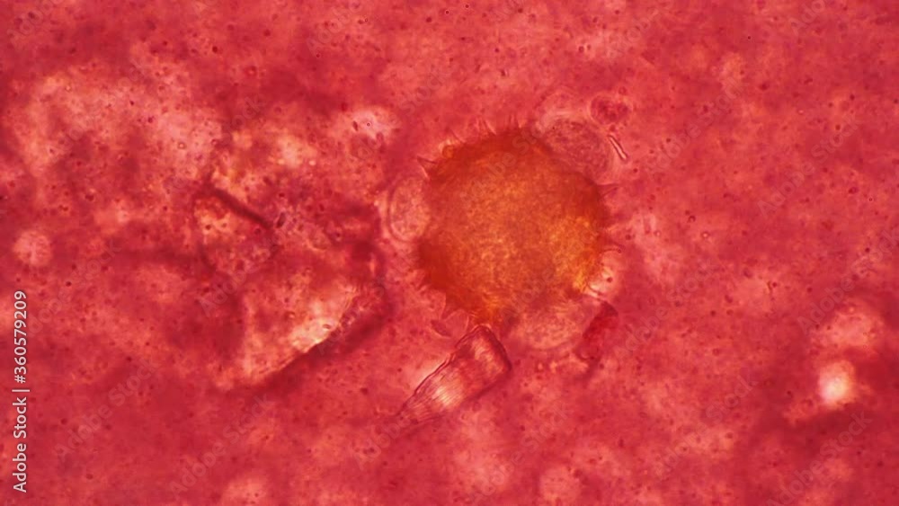 A pathogenic virus cell in the blood under a close-up microscope. Theme ...