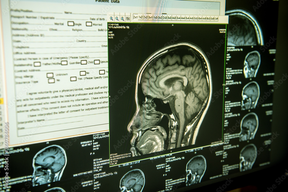 brain image on screen computer Stock Photo | Adobe Stock