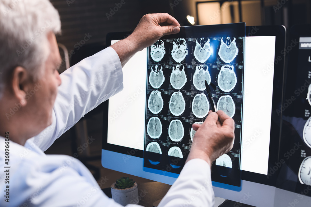 Senior neurologist with MRI scan of human head in clinic Stock Photo ...