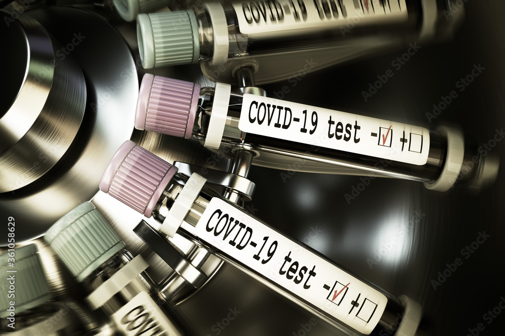 Vials of blood in a centrifuge. Negative COVID-19 test and laboratory ...