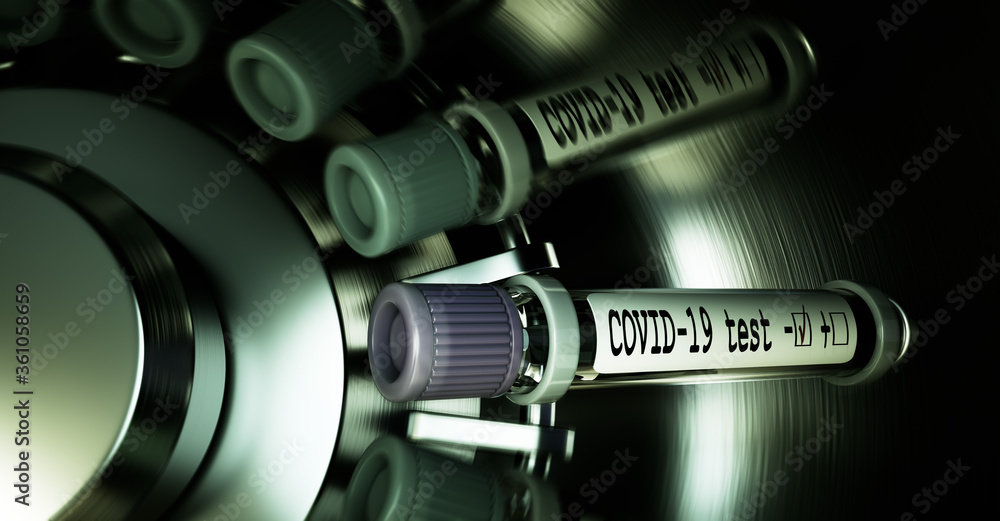 Tube of biological sample contaminated by Coronavirus with label Covid ...