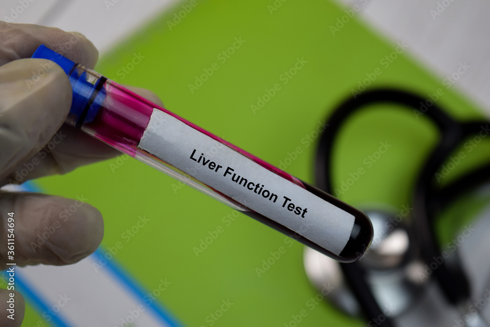 Liver Function Test text with blood sample. Top view isolated on black ...