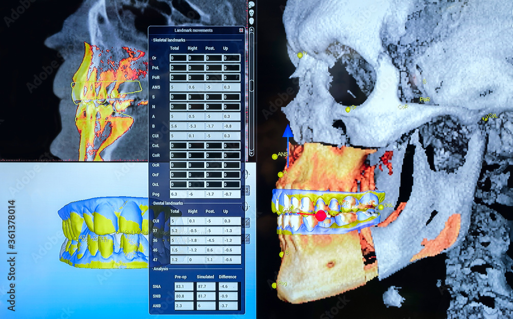 Panoramic and 3D dental x-ray many shots Stock Photo | Adobe Stock