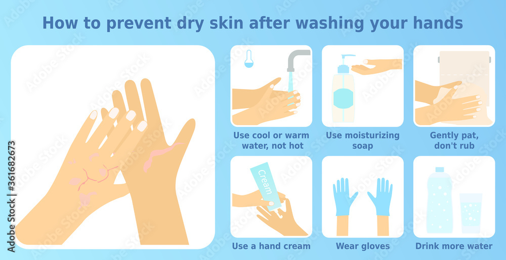 Dry Skin After Washing Hands at Mike Fahey blog