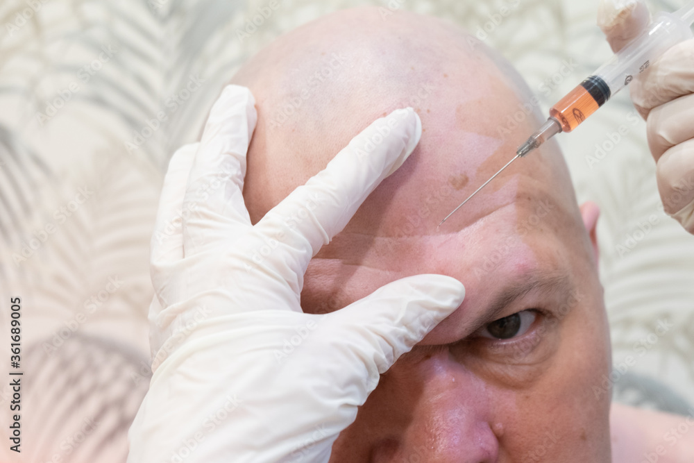 men's cosmetic operations. injections in the forehead to straighten out ...