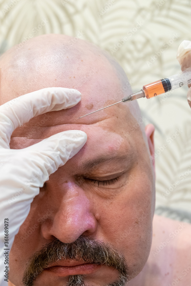 men's cosmetic operations. injections in the forehead to straighten out ...