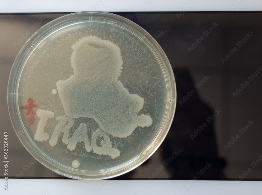 bacteria and fungi growth on plate contain agar media Stock Photo ...
