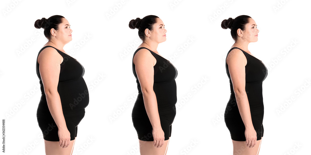 Collage with photos of overweight woman before and after weight loss on ...