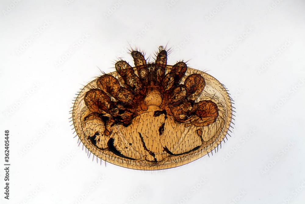 A varroa mite, Varroa destructor, under the microscope Stock Photo ...