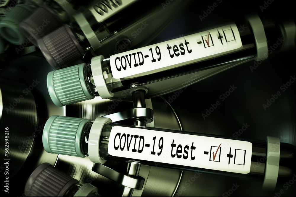 Tube of biological sample contaminated by Coronavirus with label Covid ...