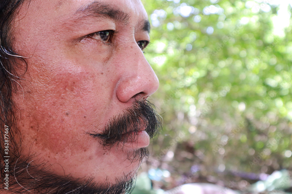Half-Asian male portraits portray age and facial skin problems Stock ...