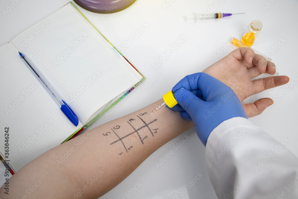 An allergist doctor in the laboratory conducts a prik allergy test ...