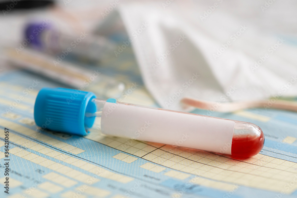 Blood in test tubes and investigation form with a blank label for ...