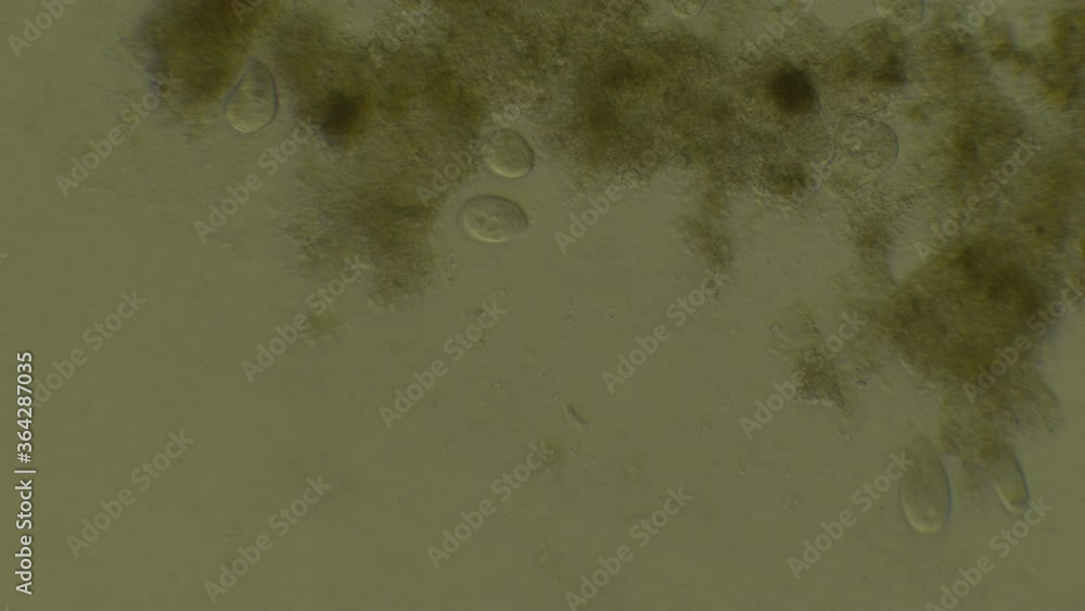Microscopy of protozoa microorganisms in the water, showing ciliates ...