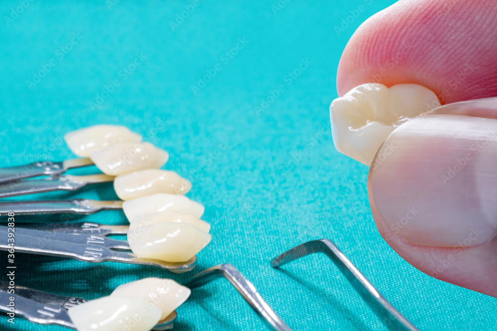 Closeup / Prosthodontics or Prosthetic / Single teeth crown and bridge ...