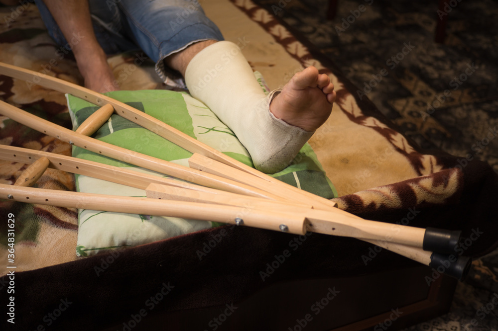 Foto de Gypsum is imposed on the man’s leg and walking on crutches is ...