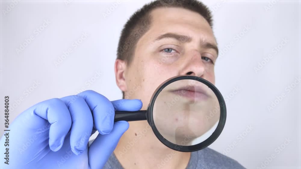 Acne close-up. A woman is being examined by a doctor. Dermatologist ...