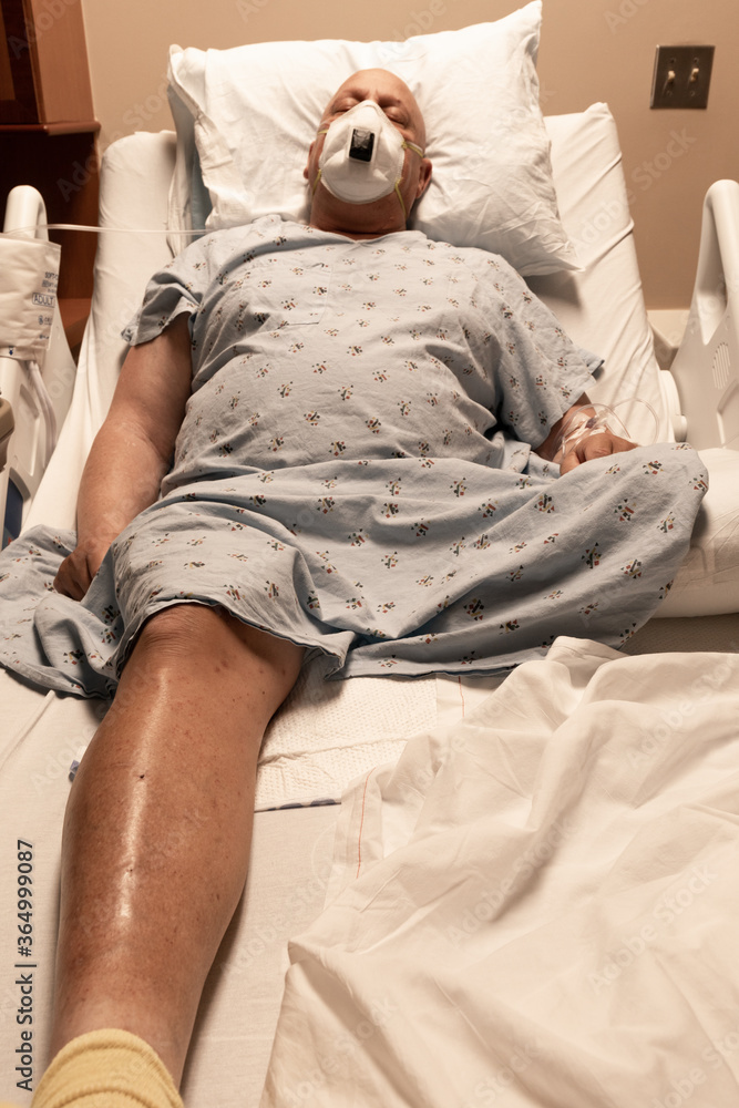 Man in a hospital bed asleep wearing a respirator, leg amputee ...