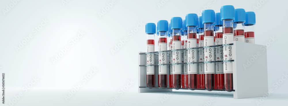 Coronavirus Covid19 test tubes in a rack. Medical screening and Covid ...