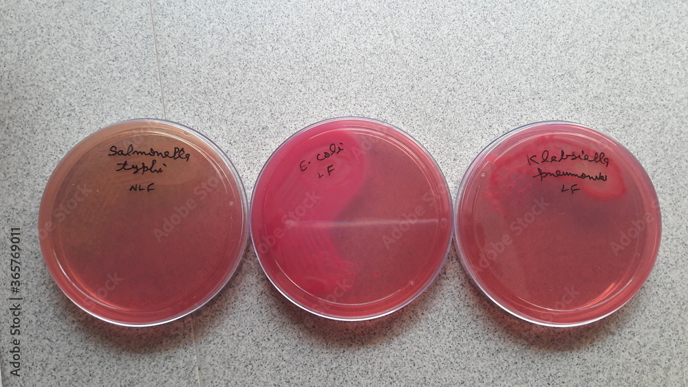 Picture of bacterial culture plates in a laboratory Stock Photo | Adobe ...