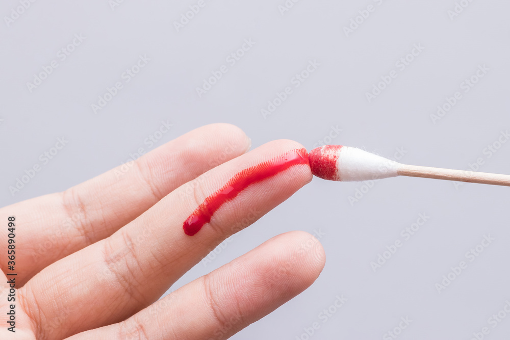 Use a cotton swab to wipe the blood at the wound on fingertips that are ...