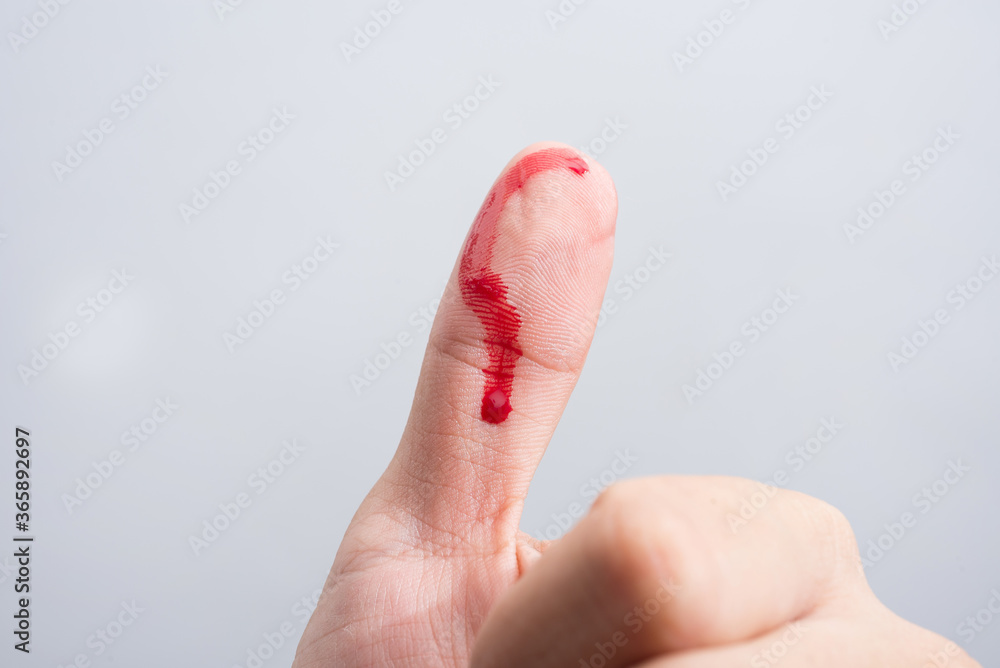 Bleeding blood from the cut finger wound. Injured finger with bleeding ...