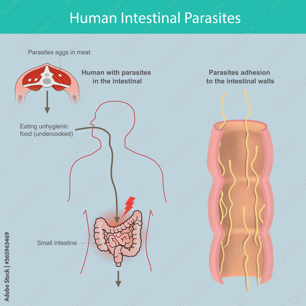 Human Intestinal Parasites. Illustration explain the parasites in human ...