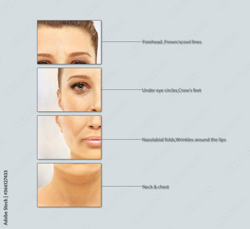 Effects of ageing,Frown/scowl lines ,Nasolabial folds,Neck ,Under eye ...