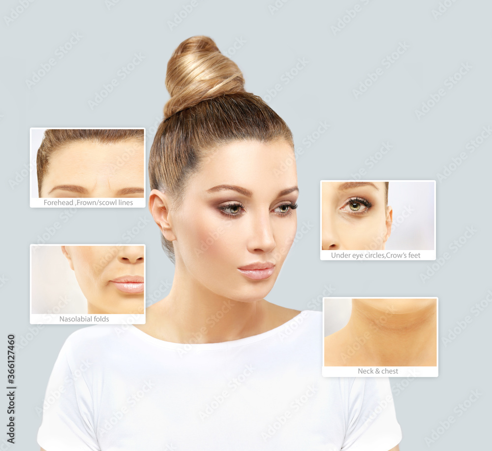 Effects of ageing,Frown/scowl lines ,Nasolabial folds,Neck ,Under eye ...