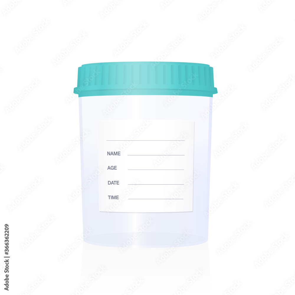 Specimen cup, empty with blank sticker to be labeled, medical ...