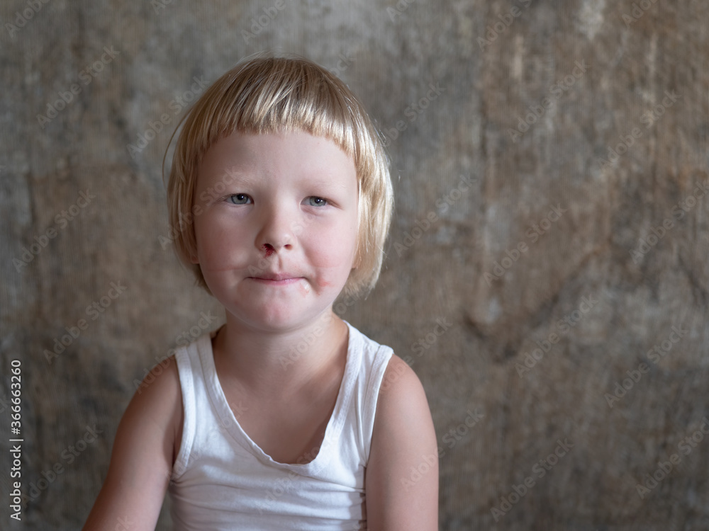 little fair-haired boy is smeared with blood. baby has weak vessels in ...
