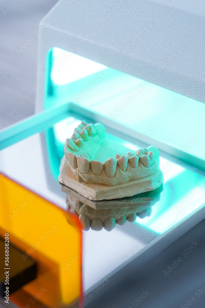High angle of upper jaw dental cast model placed in light curing unit ...