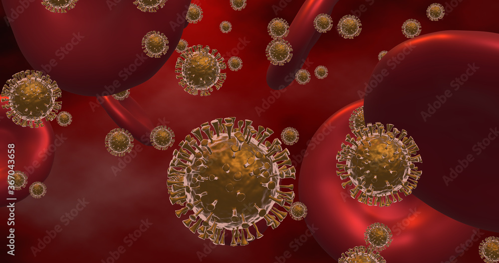 3D Visualisation of Covid-19 infection. Realistic SARS-CoV-2 2019-nCov ...