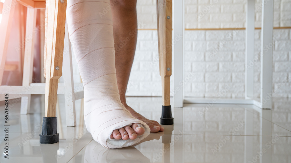 A man's leg was worn on a splint, injured by a broken bone and a staff ...