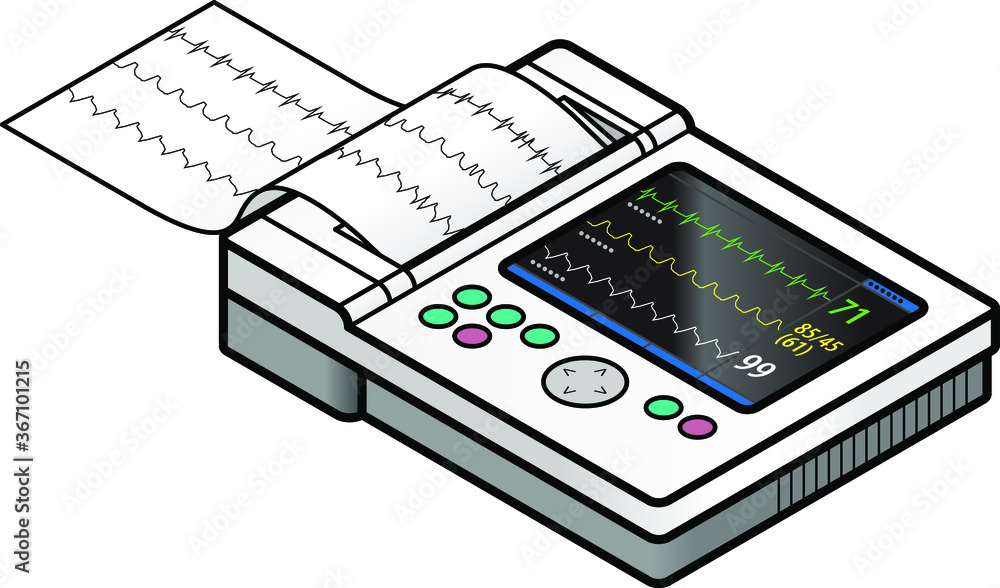An all-in-one ECG/EKG machine with an integrated printer and print-out ...