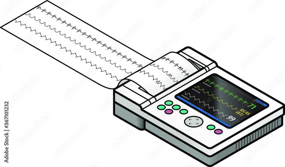 An all-in-one ECG/EKG machine with an integrated printer and print-out ...