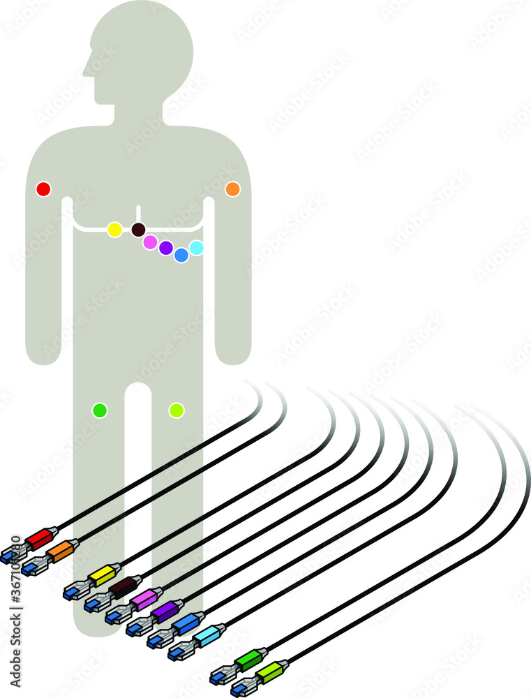 ECG wiring diagram showing 6+2+2 colour-coded sensors. Stock Vector ...