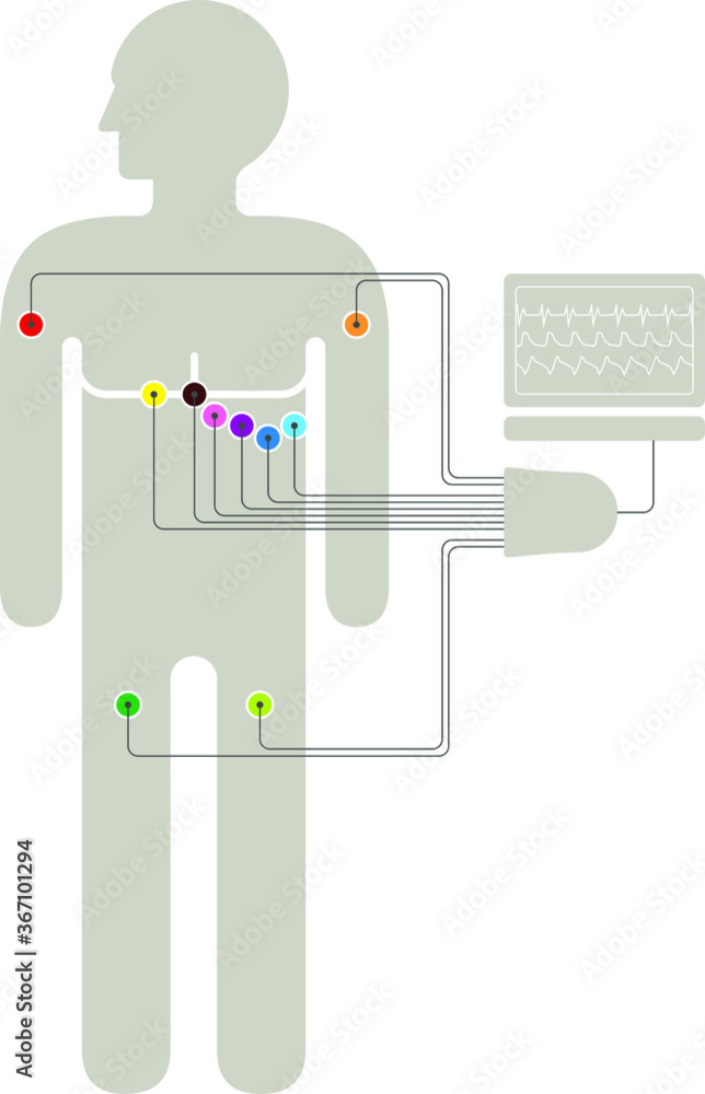 ECG wiring diagram showing 6+2+2 colour-coded sensors connected to a ...