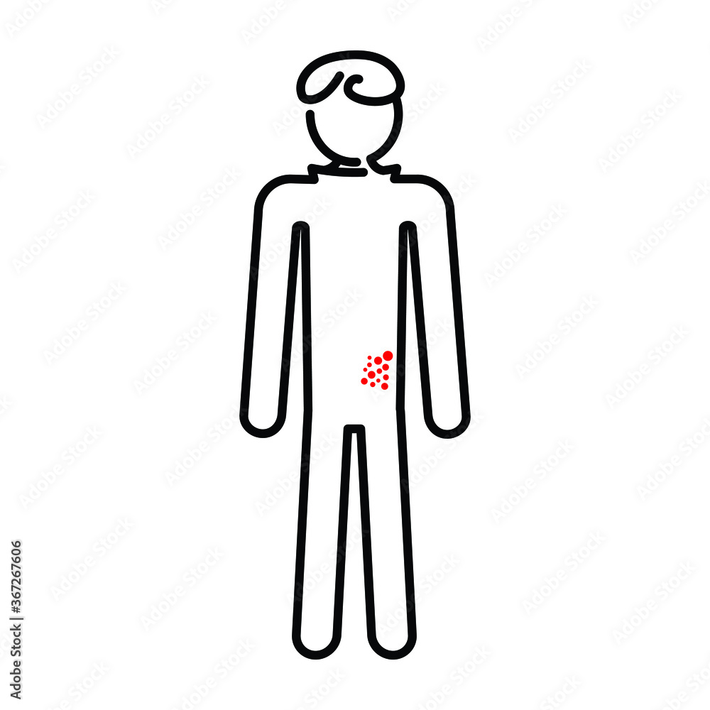 A simple stylized vector image of a man with a rash on his side. The ...