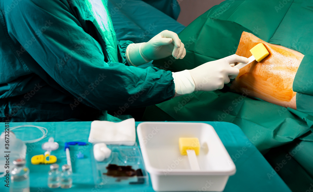 Cleaning with anti septic in the back prepare for epidural anesthesia ...