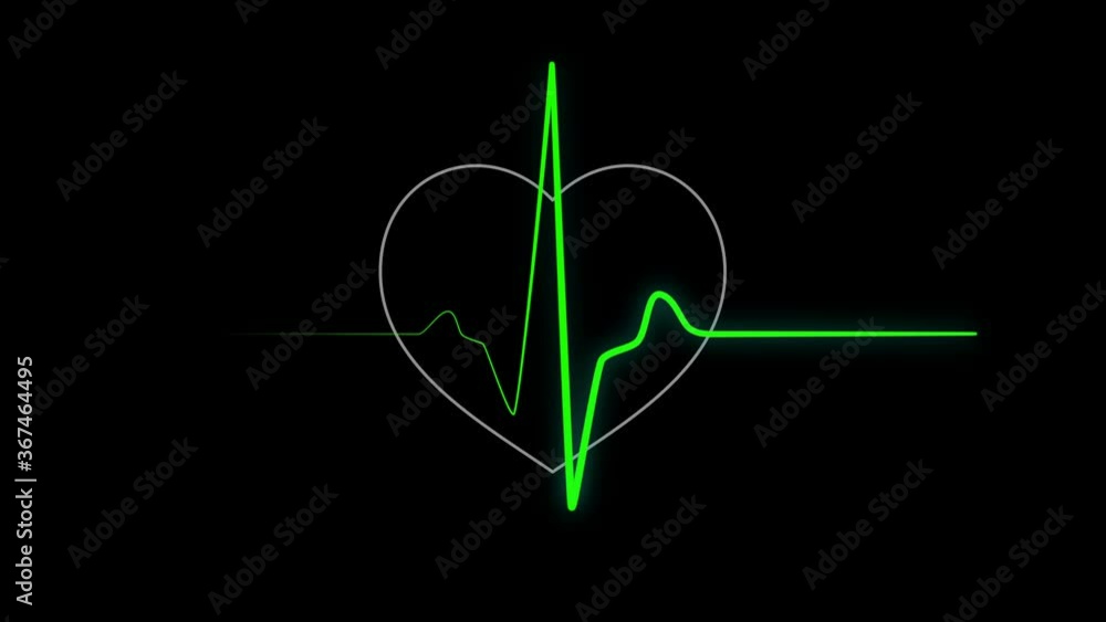 Heartbeat flatline. EKG heart rate display screen medical research ...