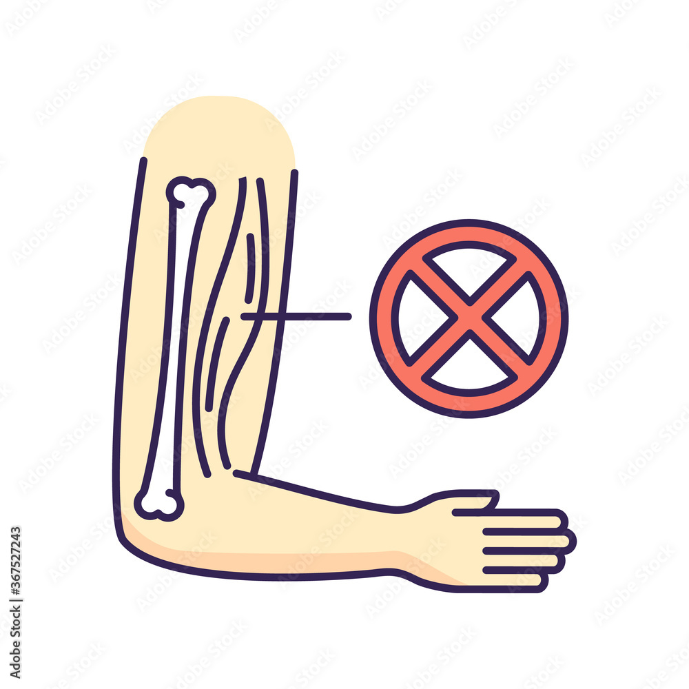 Muscular dystrophy RGB color icon. Chronic genetic disorder. Tissue ...