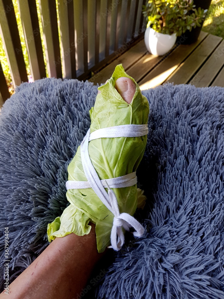Wrapped legs with white cabbage leaves.Cabbage Leaves Can Pull Out ...