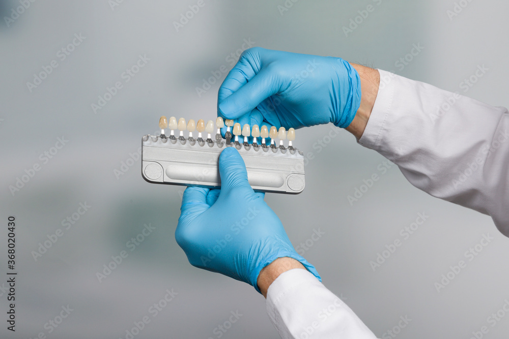 Close up of dentist's hands choosing a shade guide to check veneer for ...
