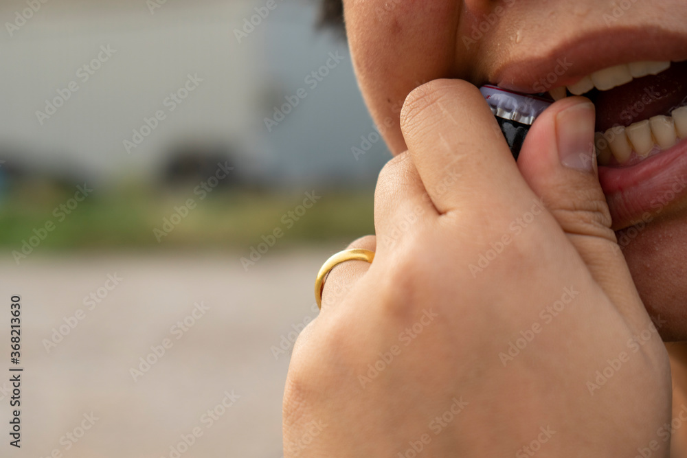Foto de Use teeth to open the beer for speed. Requires a lot of tooth ...