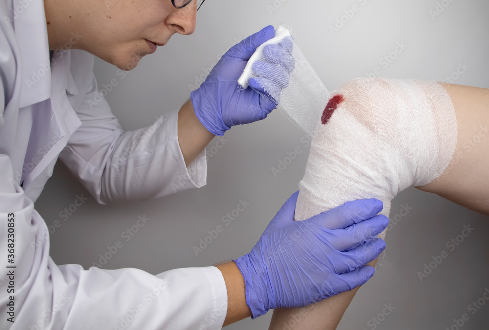 The doctor bandages the knee of a girl who is injured. Stopping ...