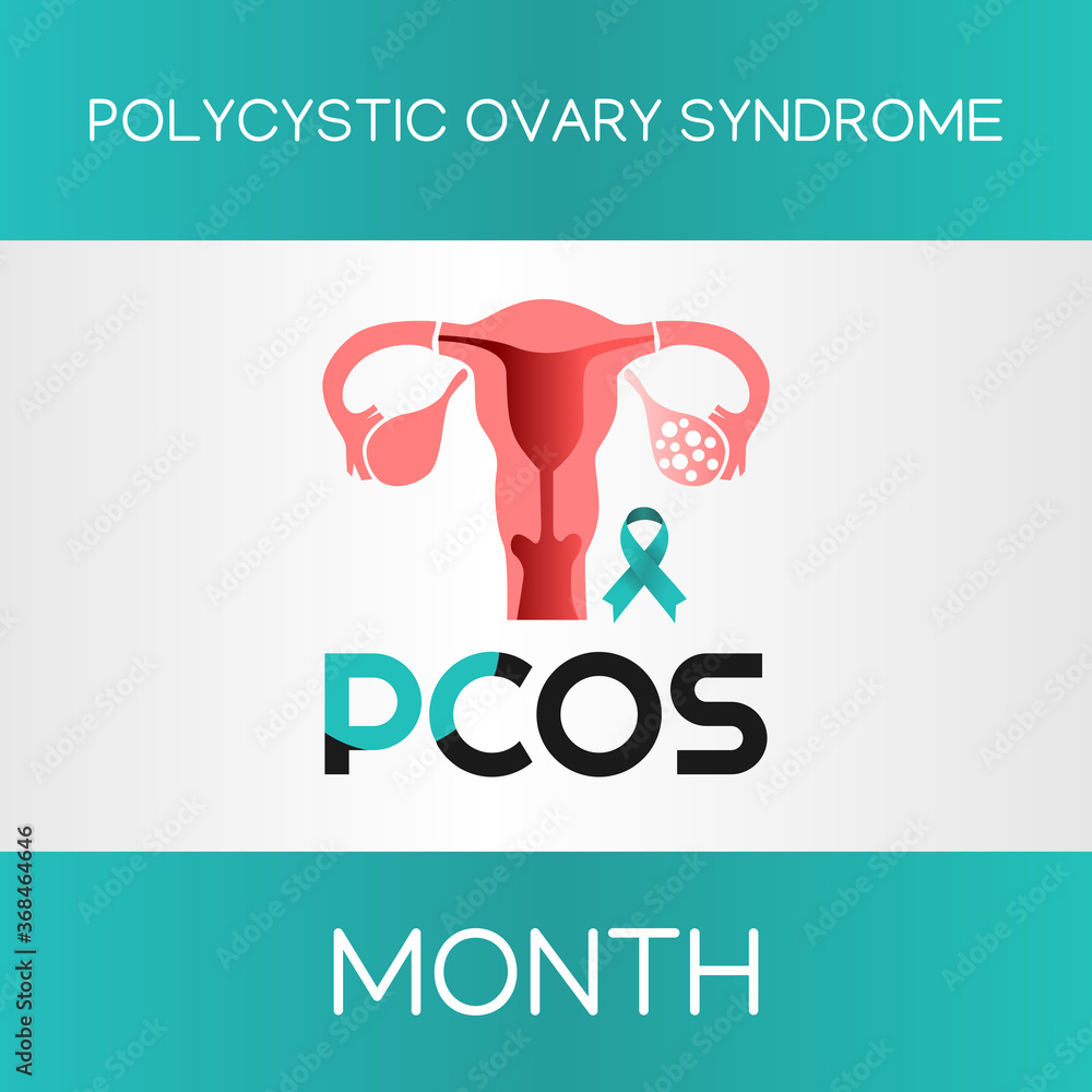 vector graphic of Polycystic Ovary Syndrome month good for Polycystic ...