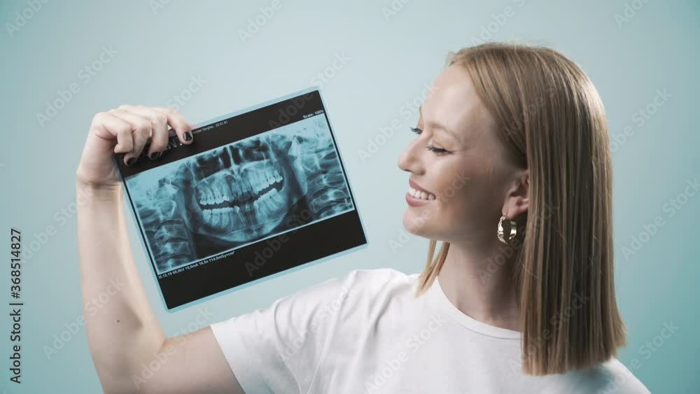 Happy smiling woman hold dental x ray of teeth and showing close up to ...