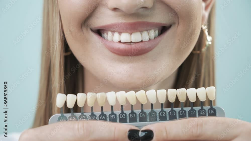 Smiling female mouth with natural white teeth and teeth color palette ...
